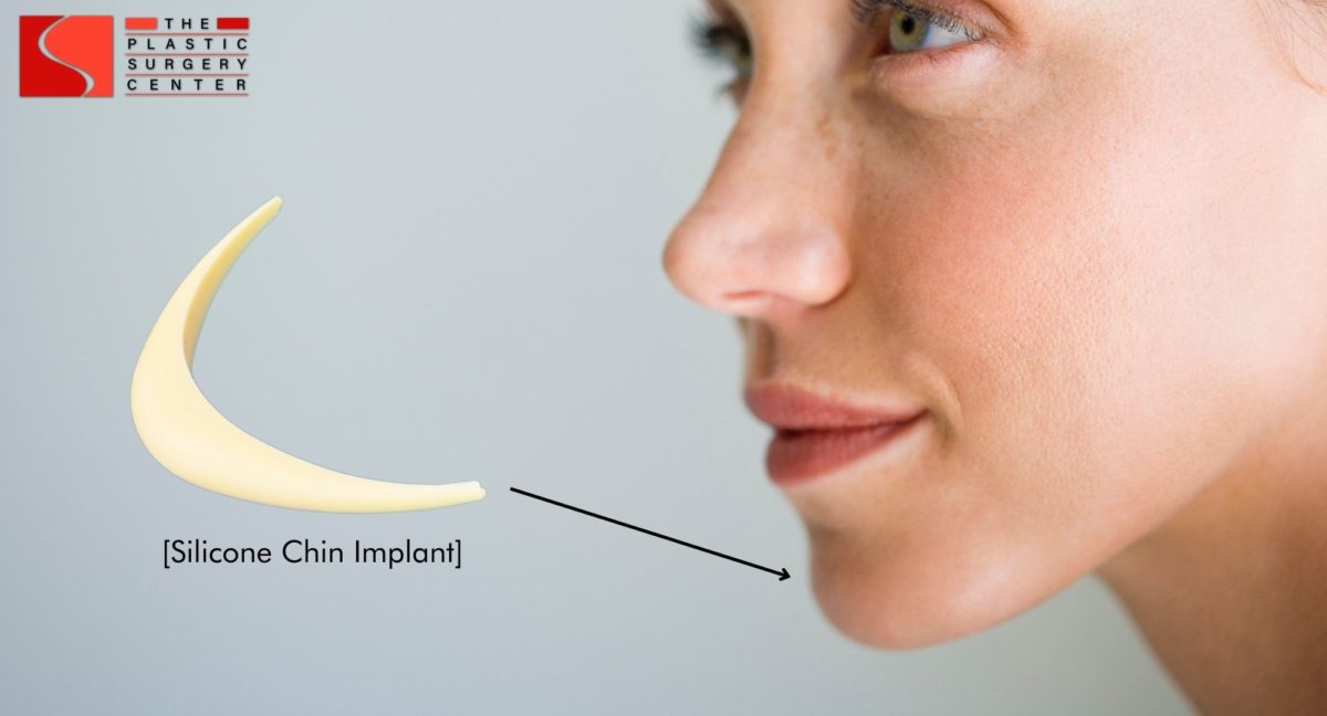 Chin Implants & Lower Jaw Surgery | The Plastic Surgery Center