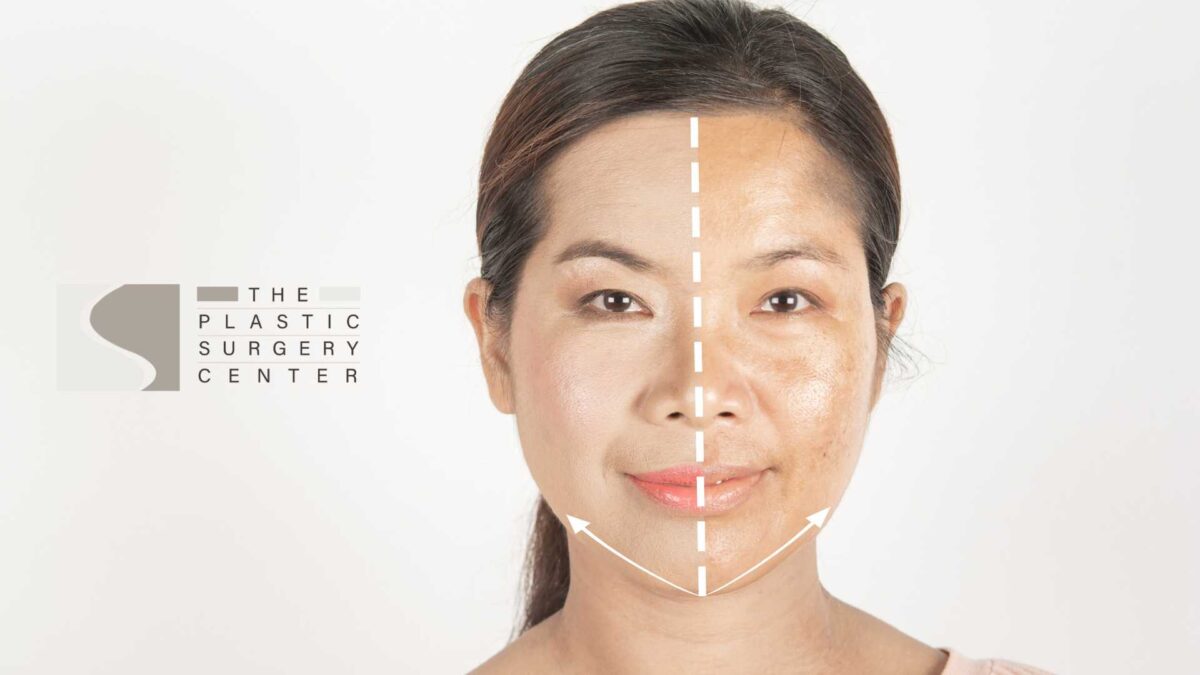 Dermatology Shreveport | Top Medical Dermatologist in Shreveport
